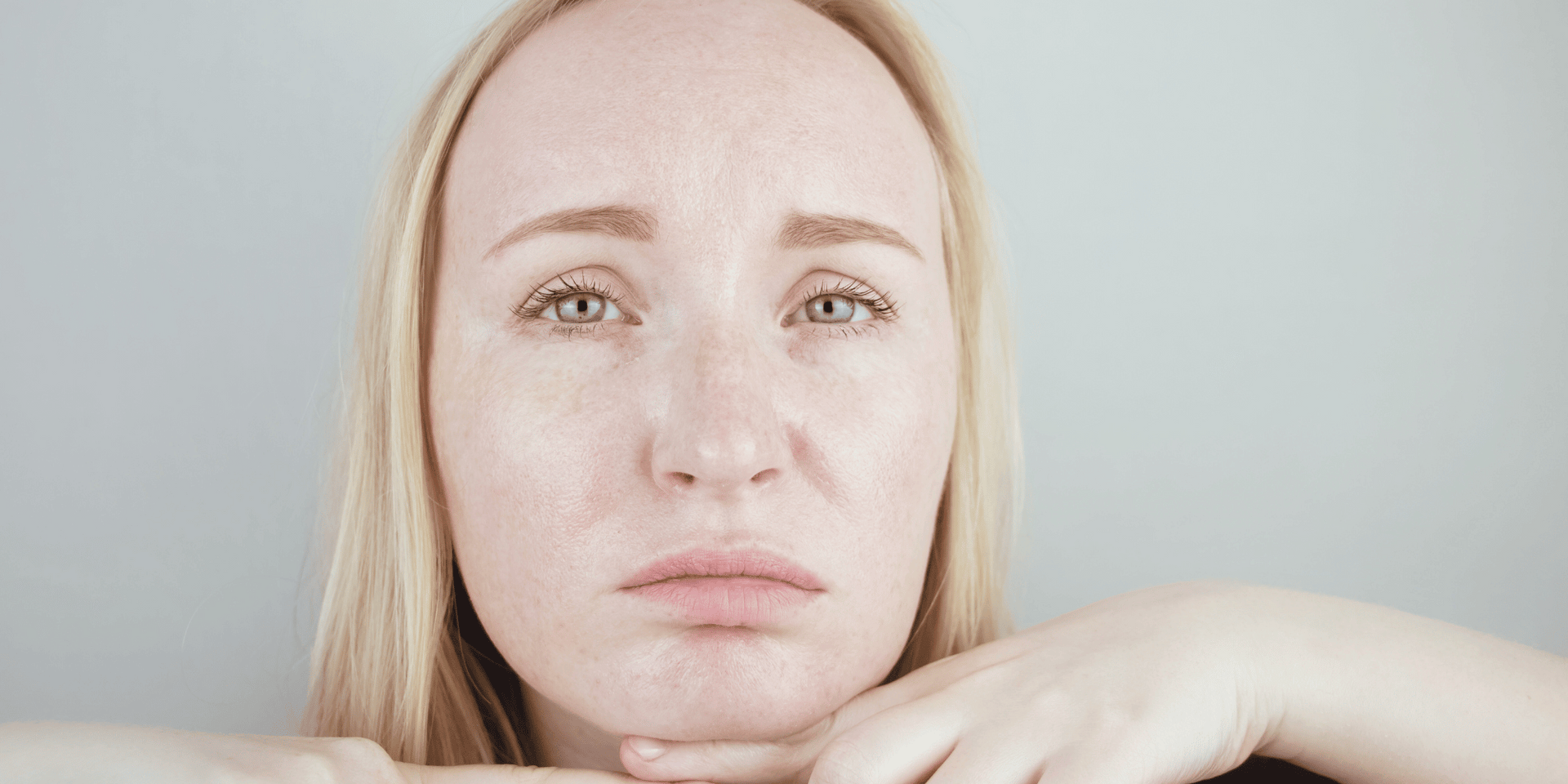 Oily Skin Ingredients Guide: Do's and Don'ts | Blossom Essentials